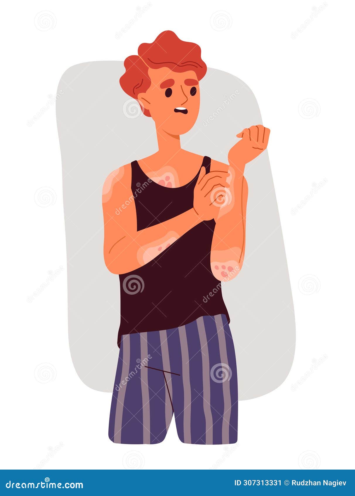 Person with Skin Disease Vector Stock Vector - Illustration of skin ...