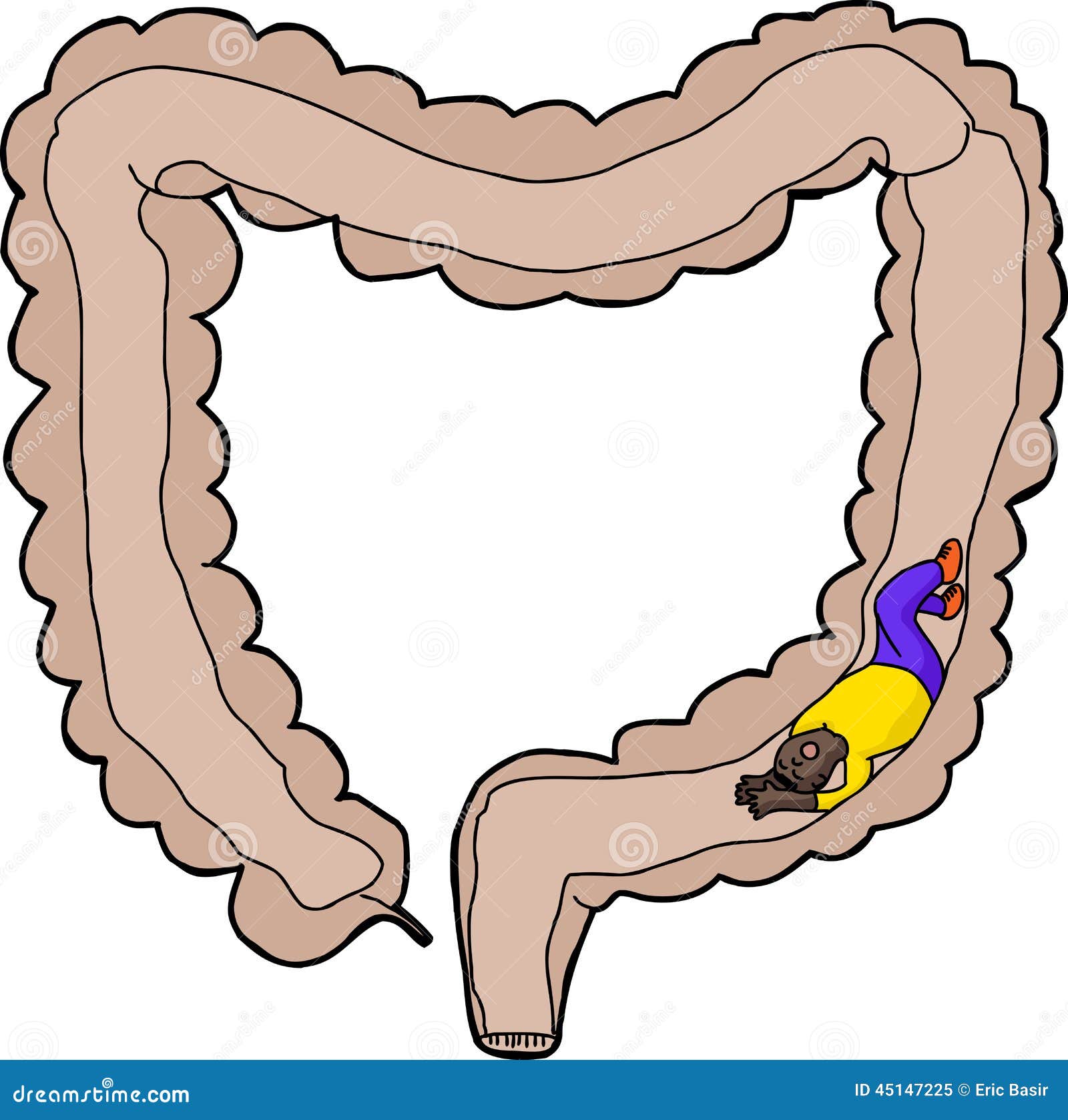 Person Stuck Inside Intestine Illustrazione Vettoriale - Illustrazione ...