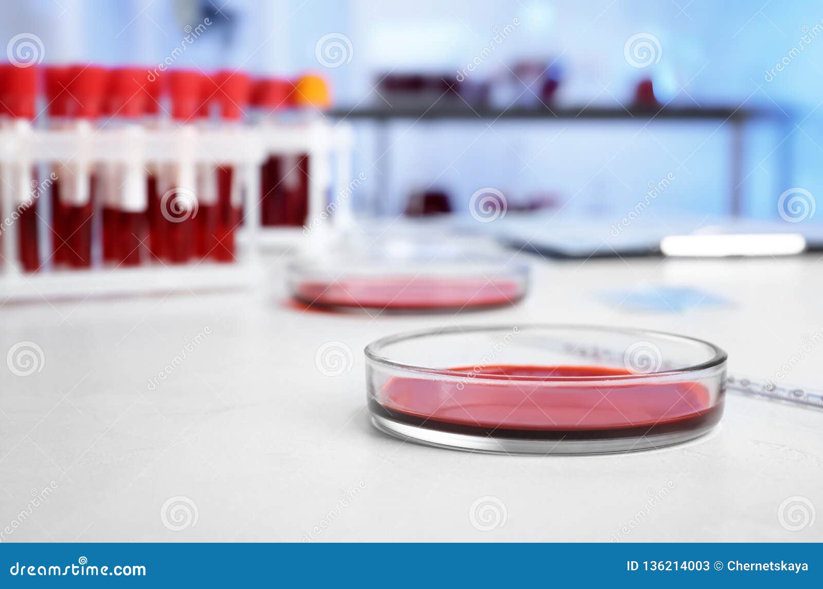 Petri Dish with Blood Sample for Analysis on Table Stock Image - Image ...
