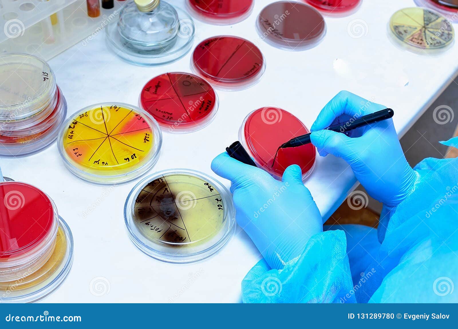 Petri Dish Microbiologisch Laboratorium Stock Foto - Image of kliniek ...