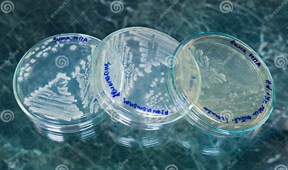 Petri Dishes Under the Microscope Stock Image - Image of legionella ...