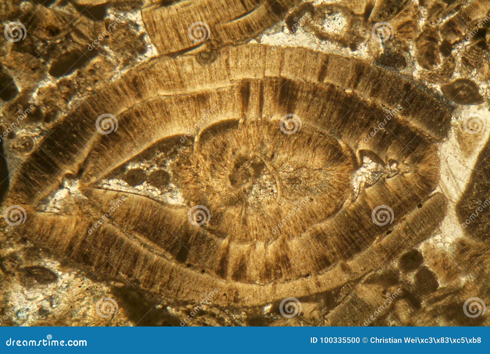 Thin Section of Nummulite Limestone Under the Microscope Stock Photo ...