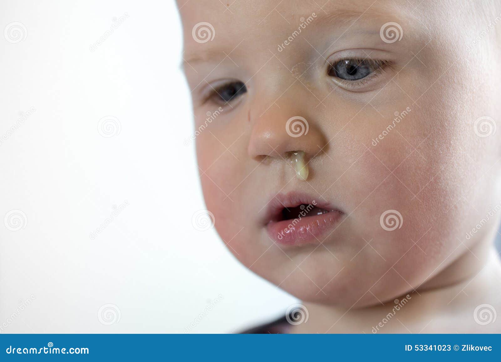 Peuter Met Snot Het Hangen Uit Neus Stock Afbeelding - Image of vuil ...
