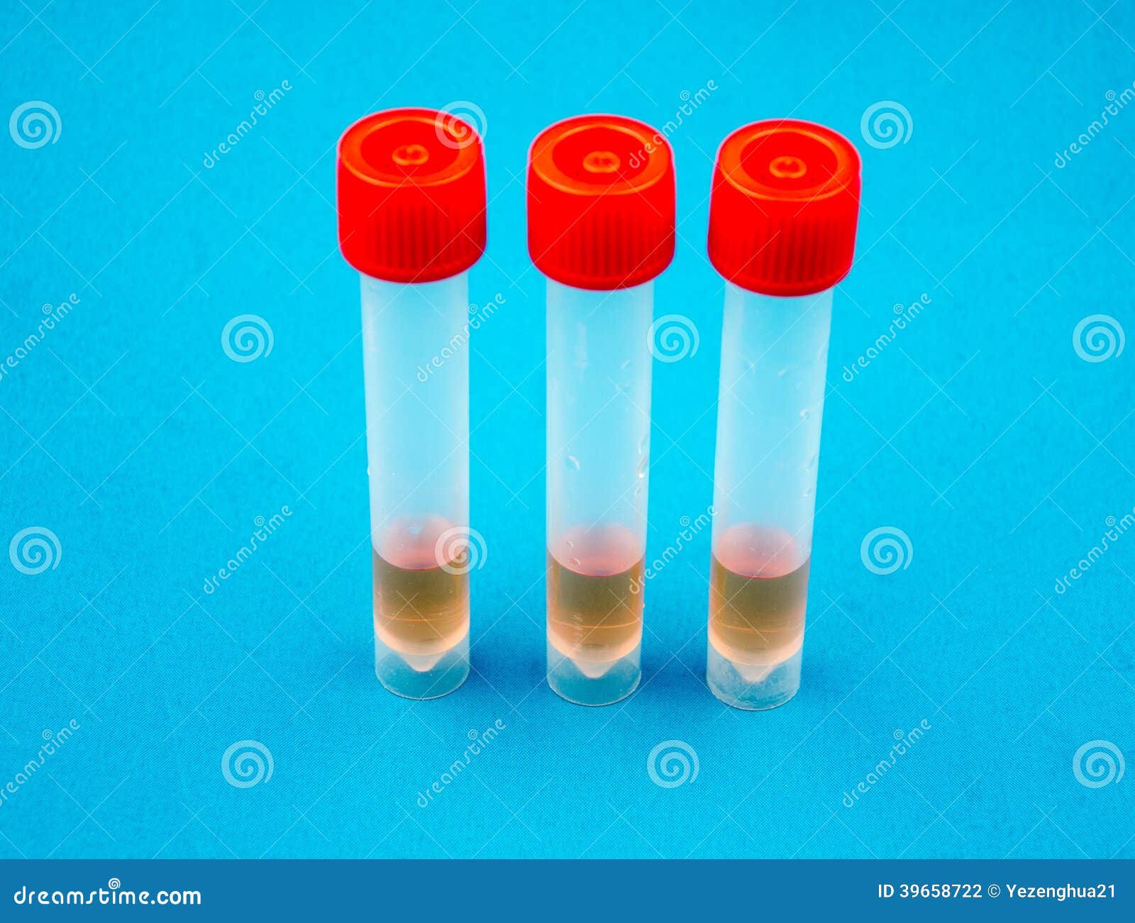 Pharyngeal swab and tube stock photo. Image of exam, office - 39658722