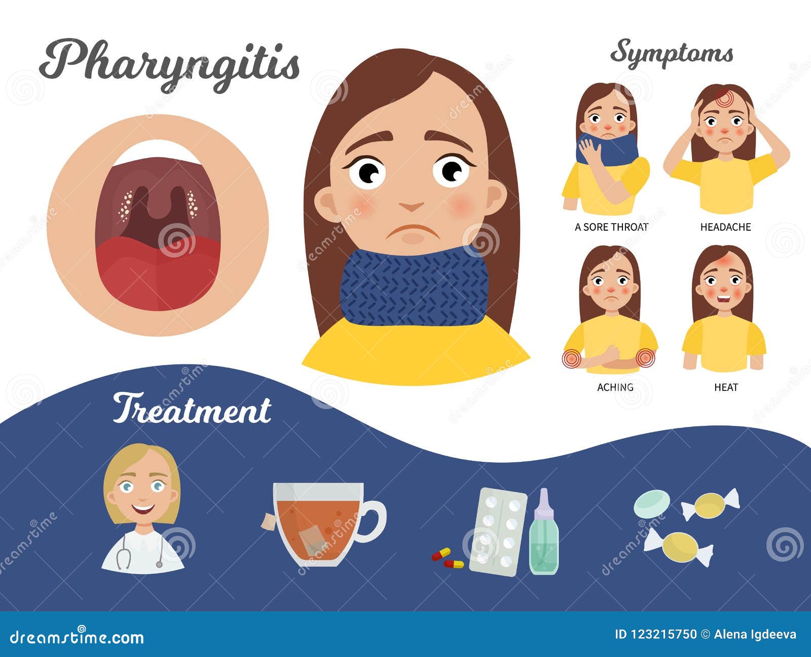 Pharyngitis infographics ilustracja wektor. Ilustracja złożonej z ...