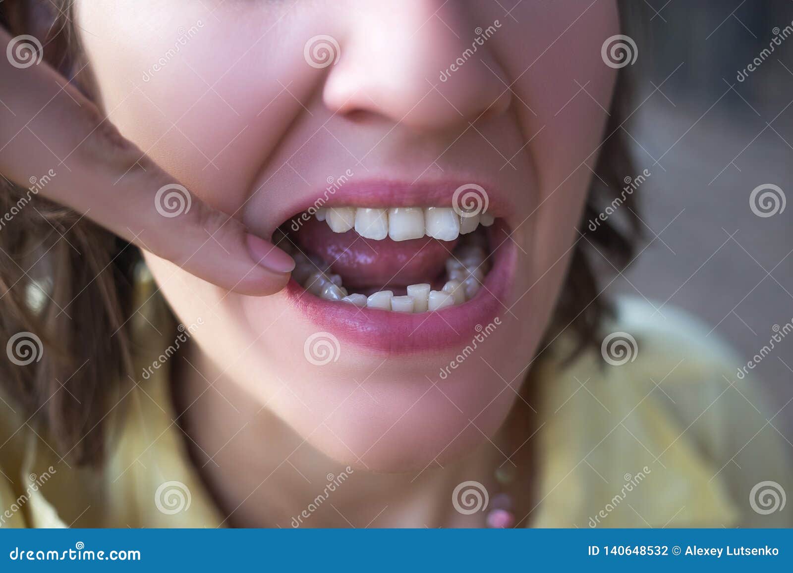 Photo of Crooked Woman Teeth Stock Photo - Image of hygiene, mouth ...
