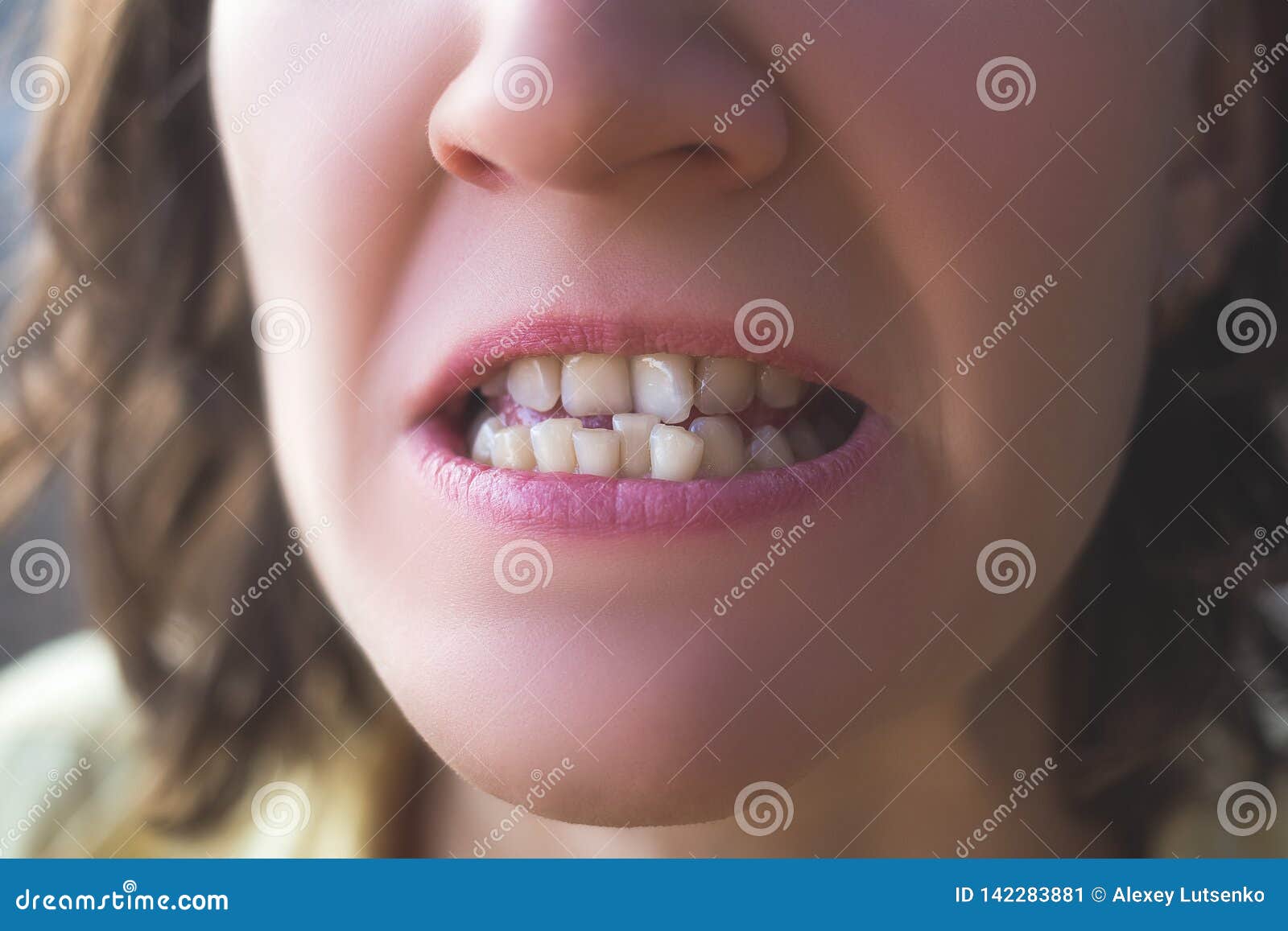 Photo of Crooked Woman Teeth Stock Image - Image of open, crowded ...