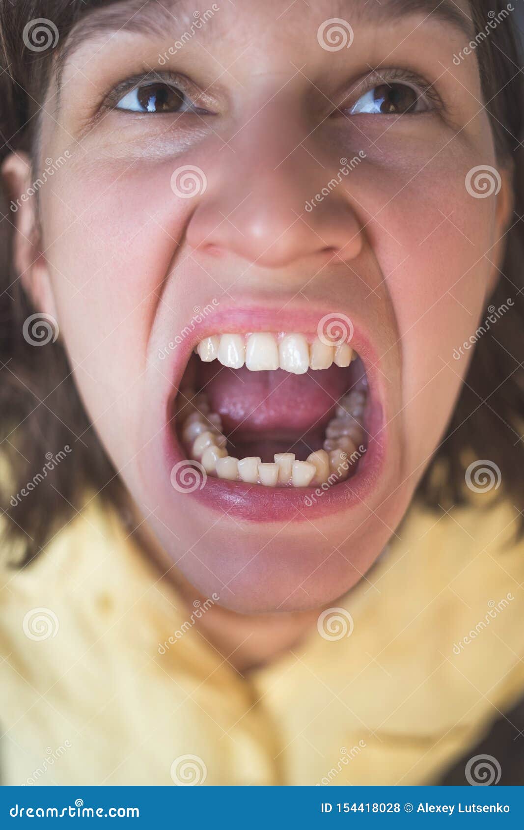 Photo of Crooked Woman Teeth Stock Photo - Image of mouth, health ...