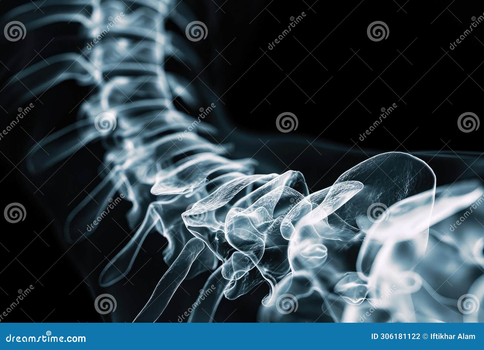 This Photo Depicts An X-ray Image Showcasing The Back View Of A Human ...