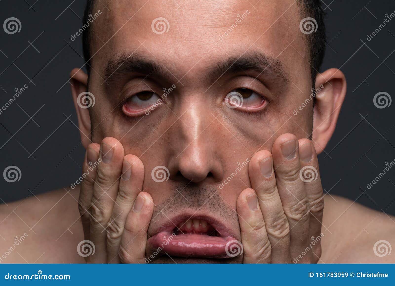Photo of Grimacing Mad Man, Close Up Stock Image - Image of wrinkle ...