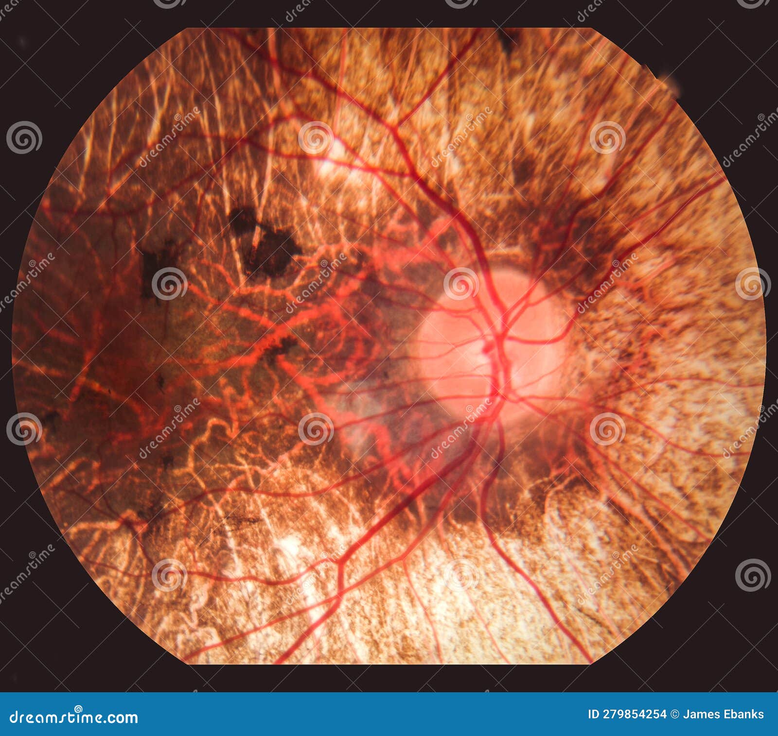 Photo Of Human Eye Retina Royalty-Free Stock Image | CartoonDealer.com ...