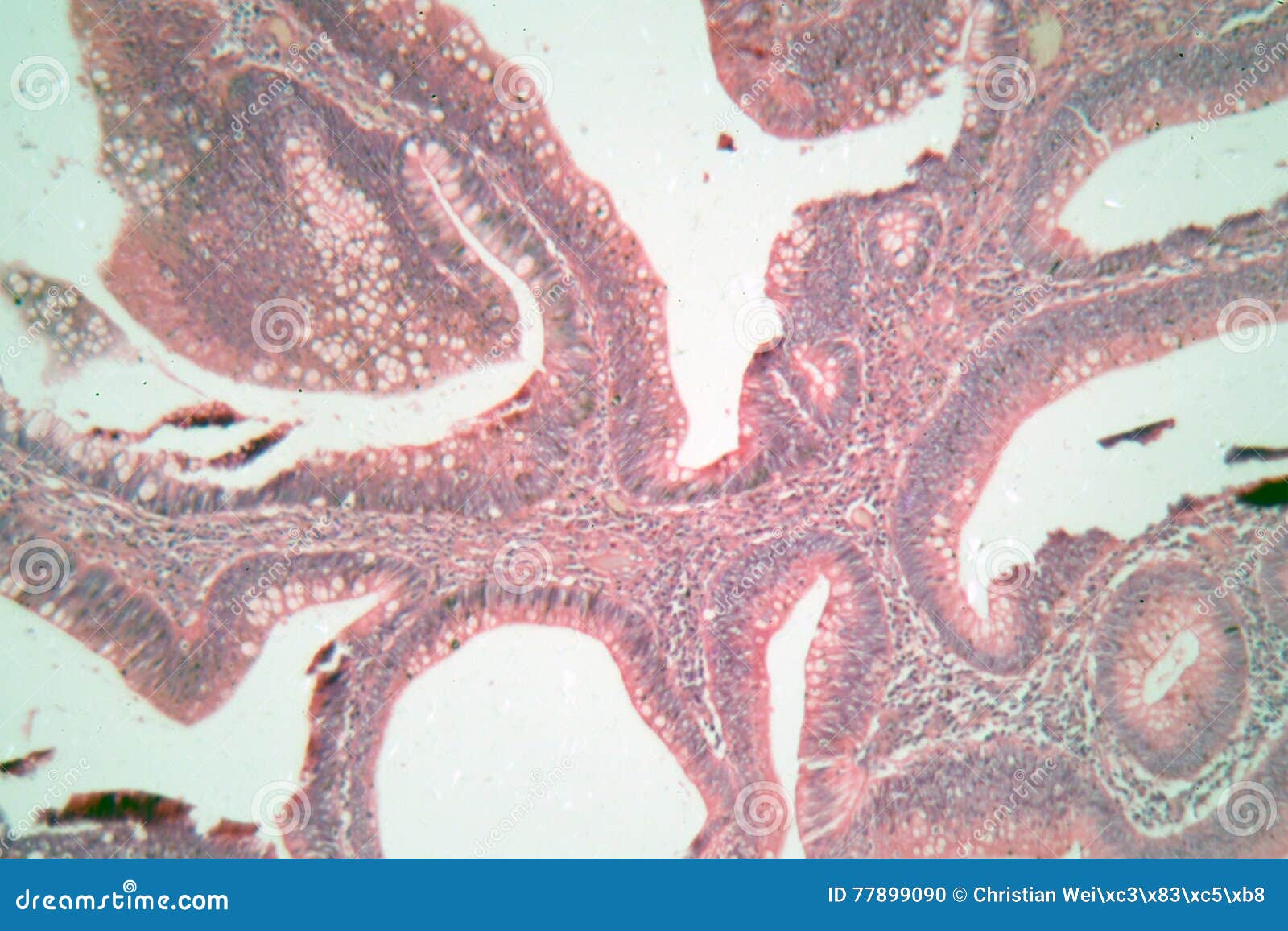 Intestine Cells Under The Microscope Stock Photography | CartoonDealer ...