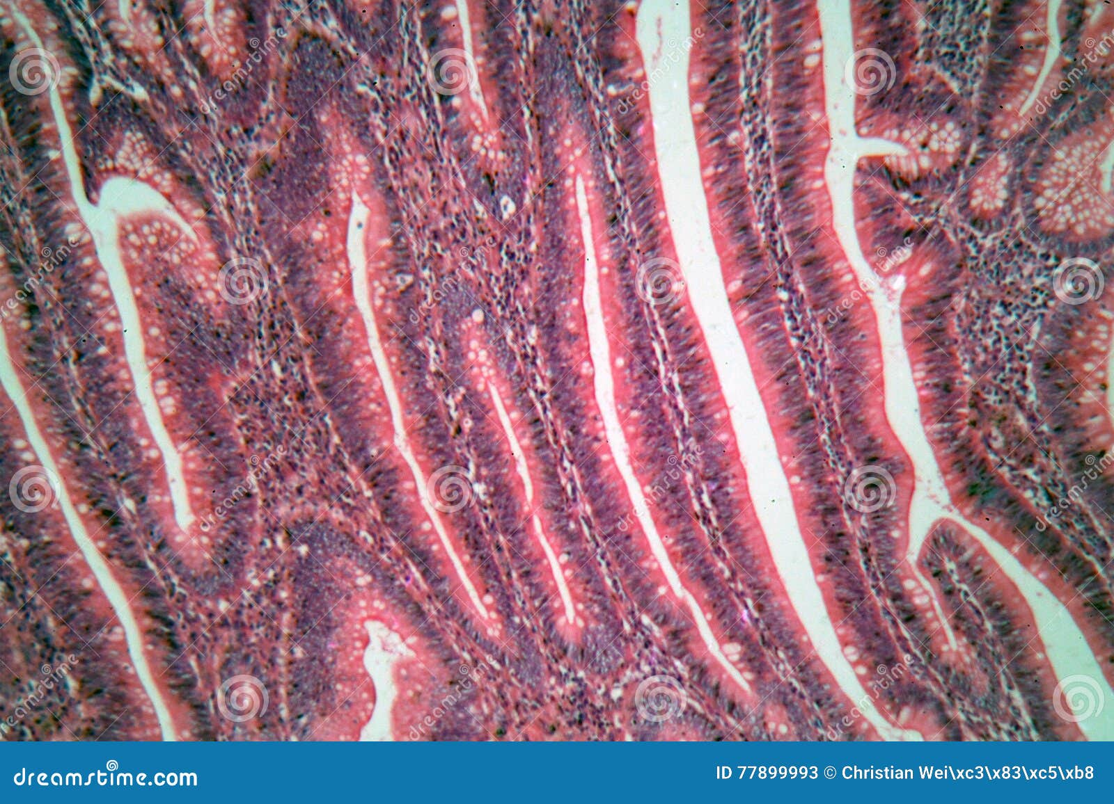 Intestine Cells Under The Microscope Stock Photography | CartoonDealer ...