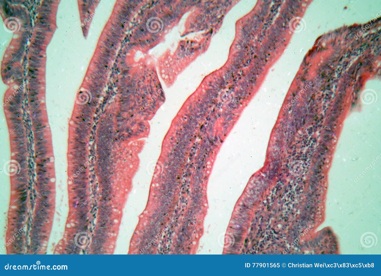 Photo of Large Intestine Cells. Stock Image - Image of human, medicine ...