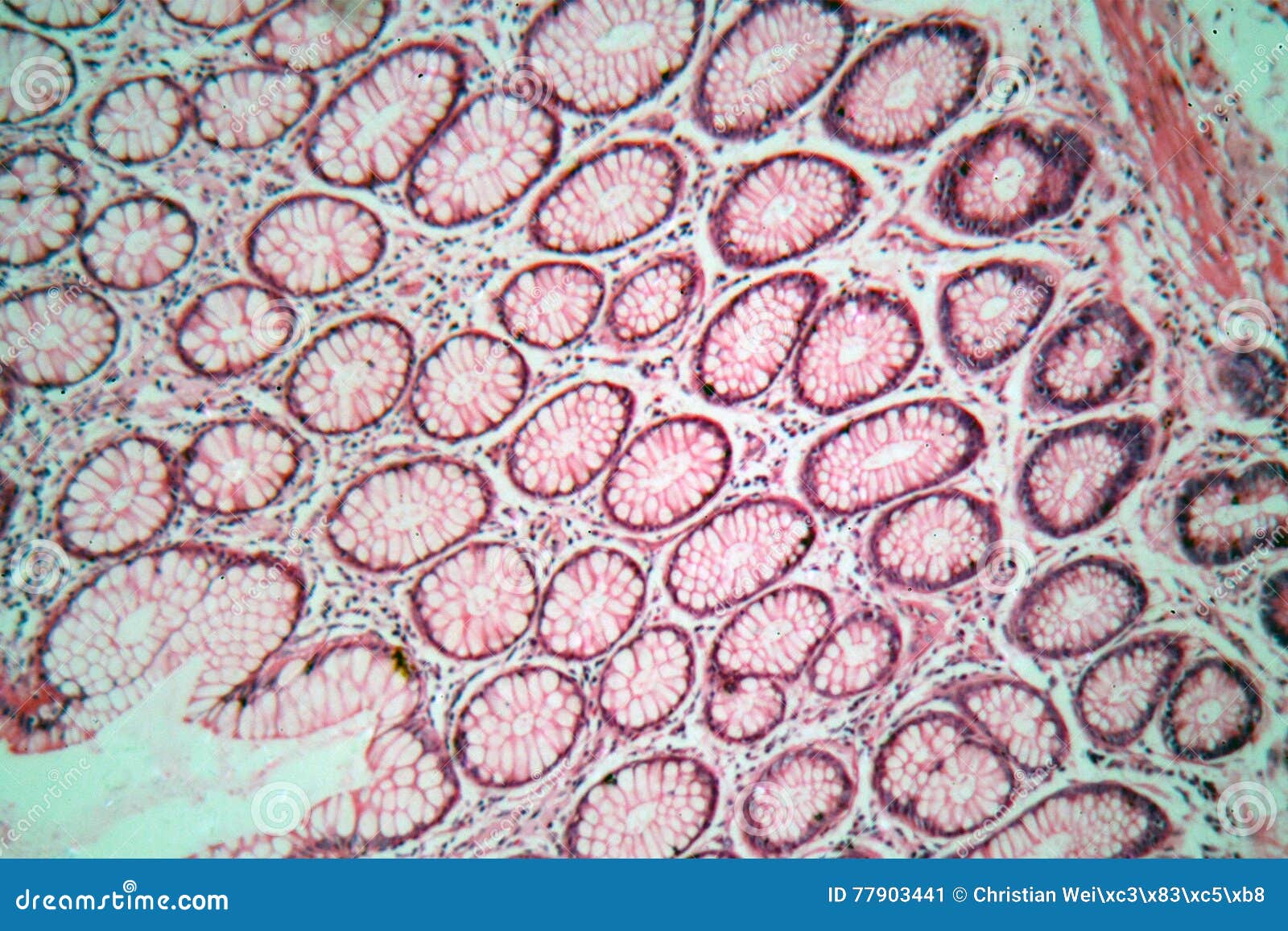 Photo of Large Intestine Cells. Stock Image - Image of health, sign ...