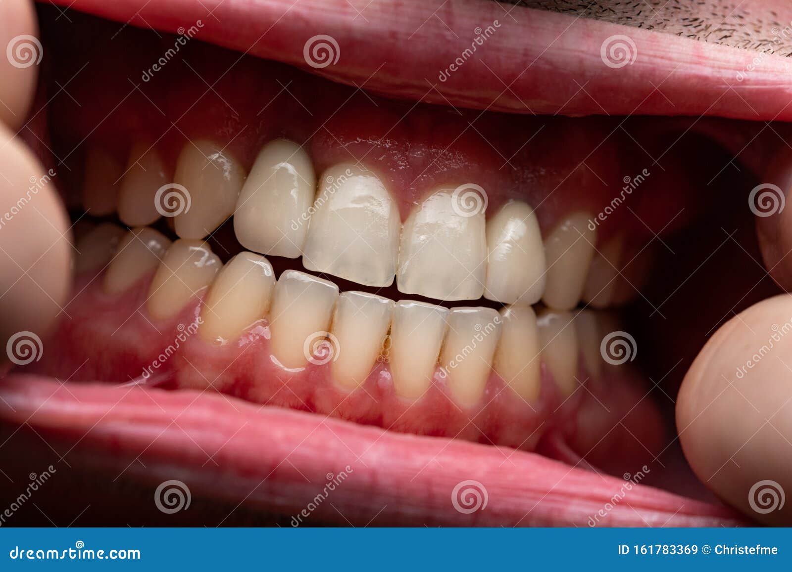 Photo of Man with Open Mouth, Showing Teeth Stock Image - Image of ...