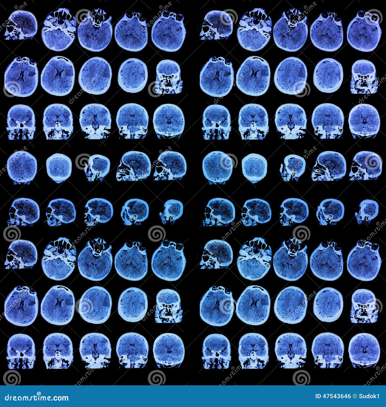 Photo of Medical Tomography. Background Stock Illustration ...