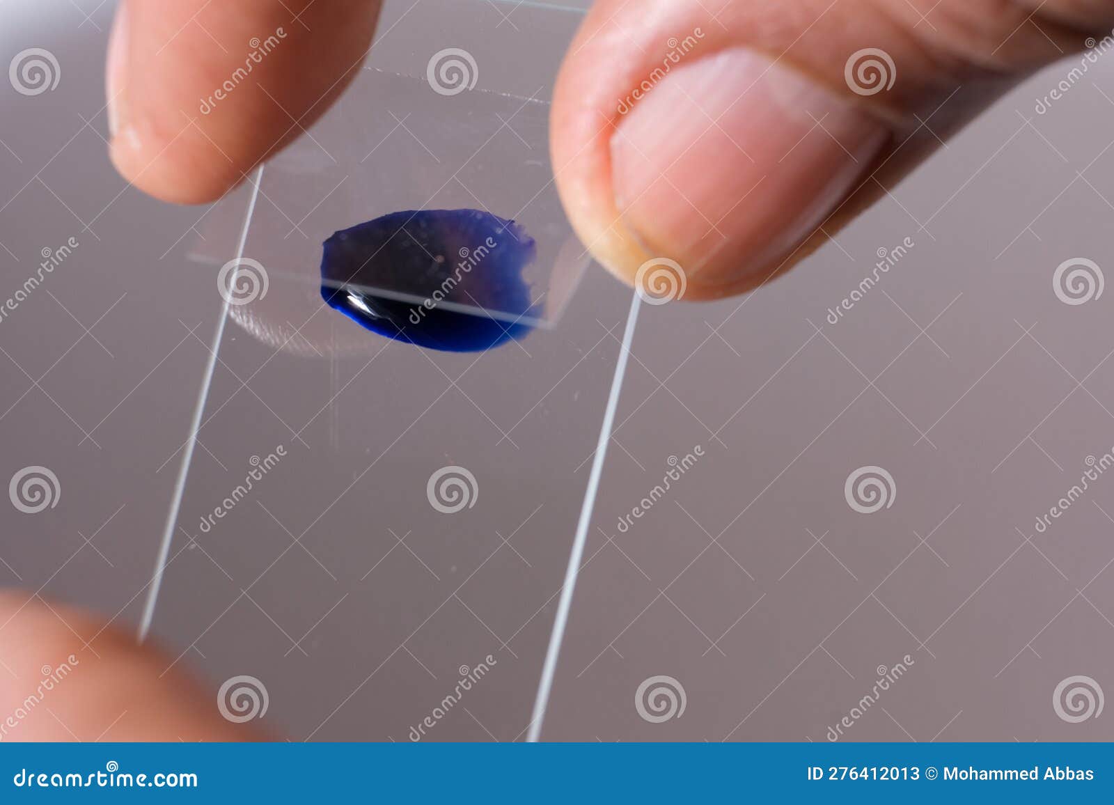 Specimen on glass slide stock image. Image of pathology - 276412013