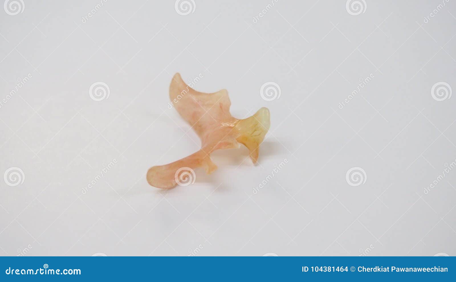 Removable Partial Denture RPD. Stock Photography | CartoonDealer.com ...