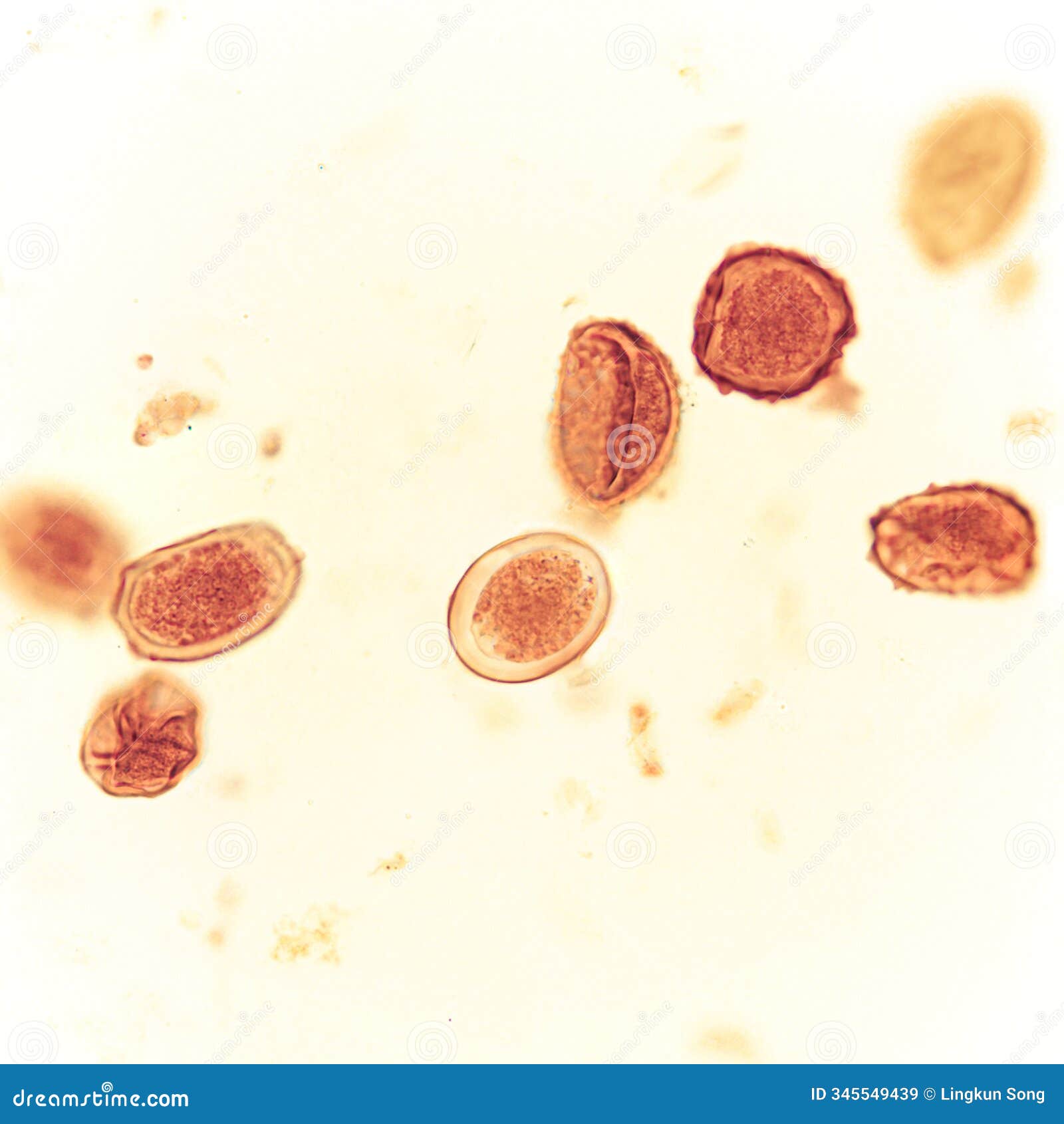 Eggs Of Ascaris Lumbricoides (roundworm) Stock Photo | CartoonDealer ...