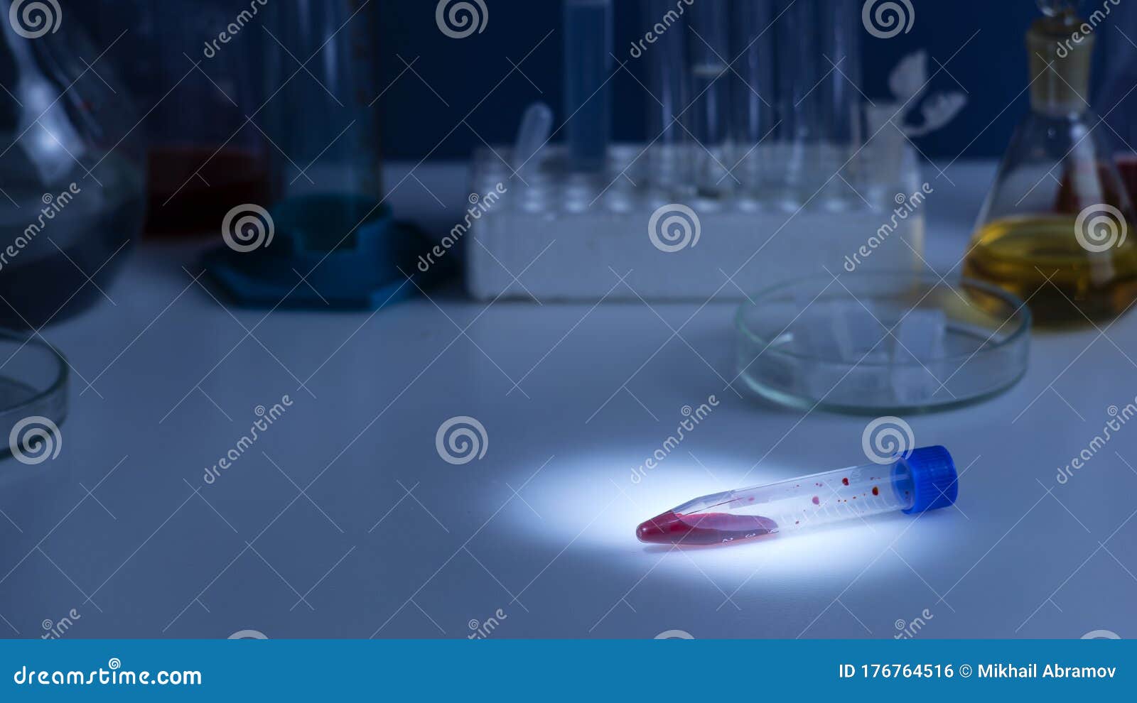 Accent Light Test Tubes with Blood Samples on Table Stock Photo - Image ...