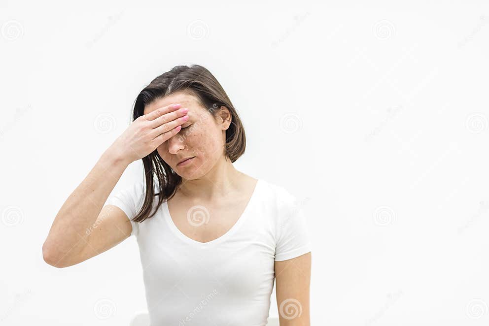 Photo Of Woman Having Skin Problems And Feeling Bad Because Of It
