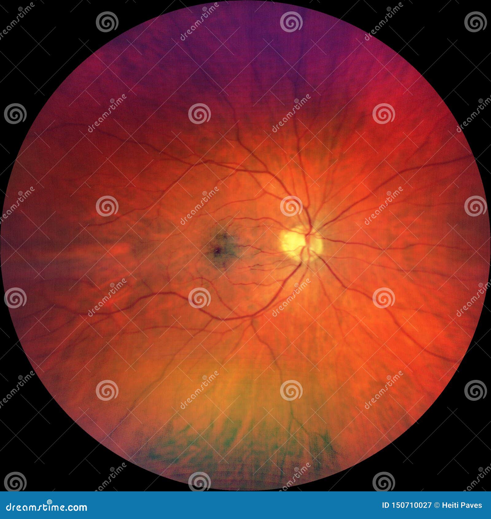Photograph Of The Fundus Oculi Stock Image | CartoonDealer.com #150709087