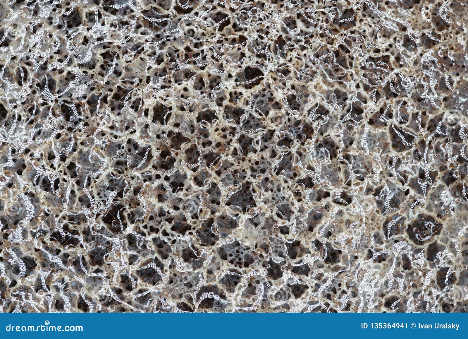 Photographic Image of Bacteria Infection Under the Microscope. Stock ...