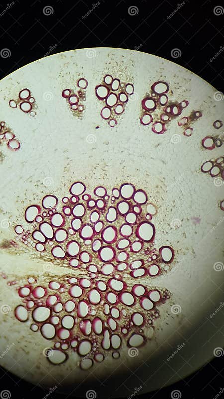 Structure of Beet Root Under a Microscope Stock Image - Image of phloem ...