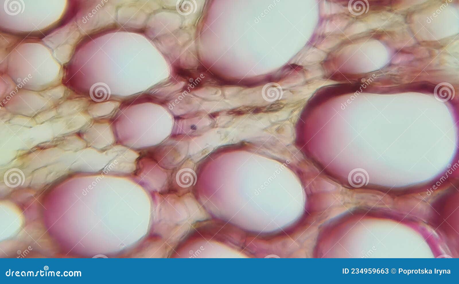Xylem Under Microscope