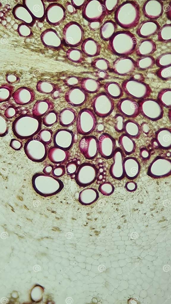 Xylem and Other Tissues of Beet Root Under a Microscope Stock Photo ...