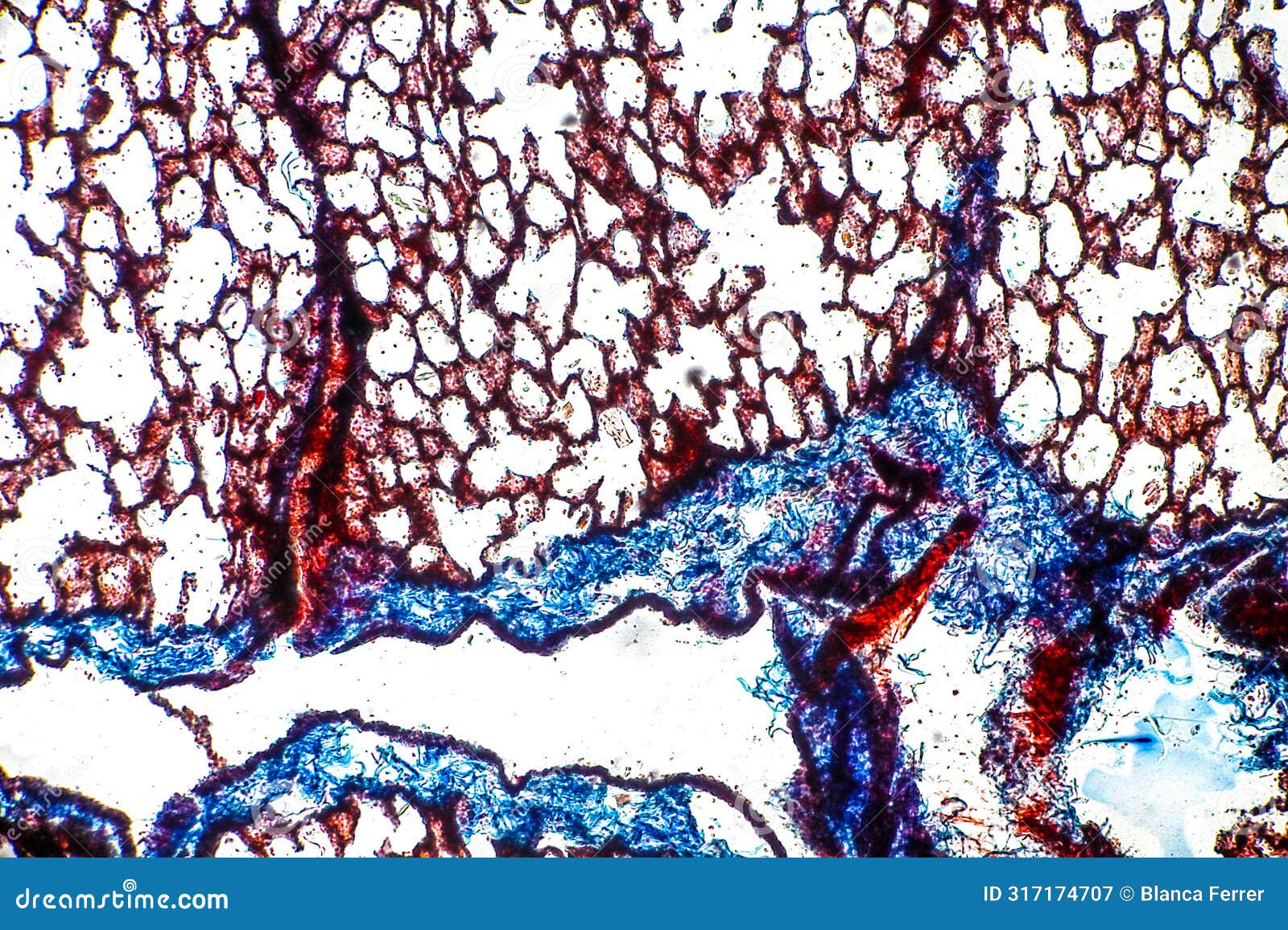 A Photomicrograph of Healthy Human Lungs Magnified 60X Stock Image ...