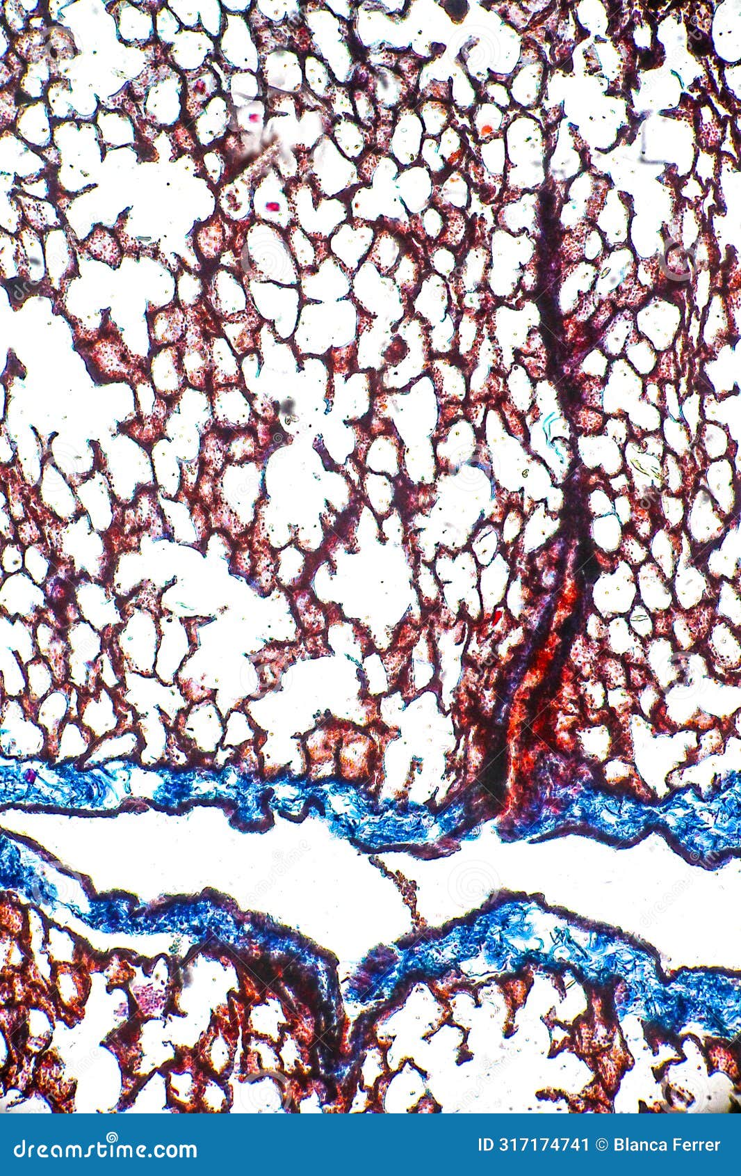 A Photomicrograph of Healthy Human Lungs Magnified 60X Stock Image ...