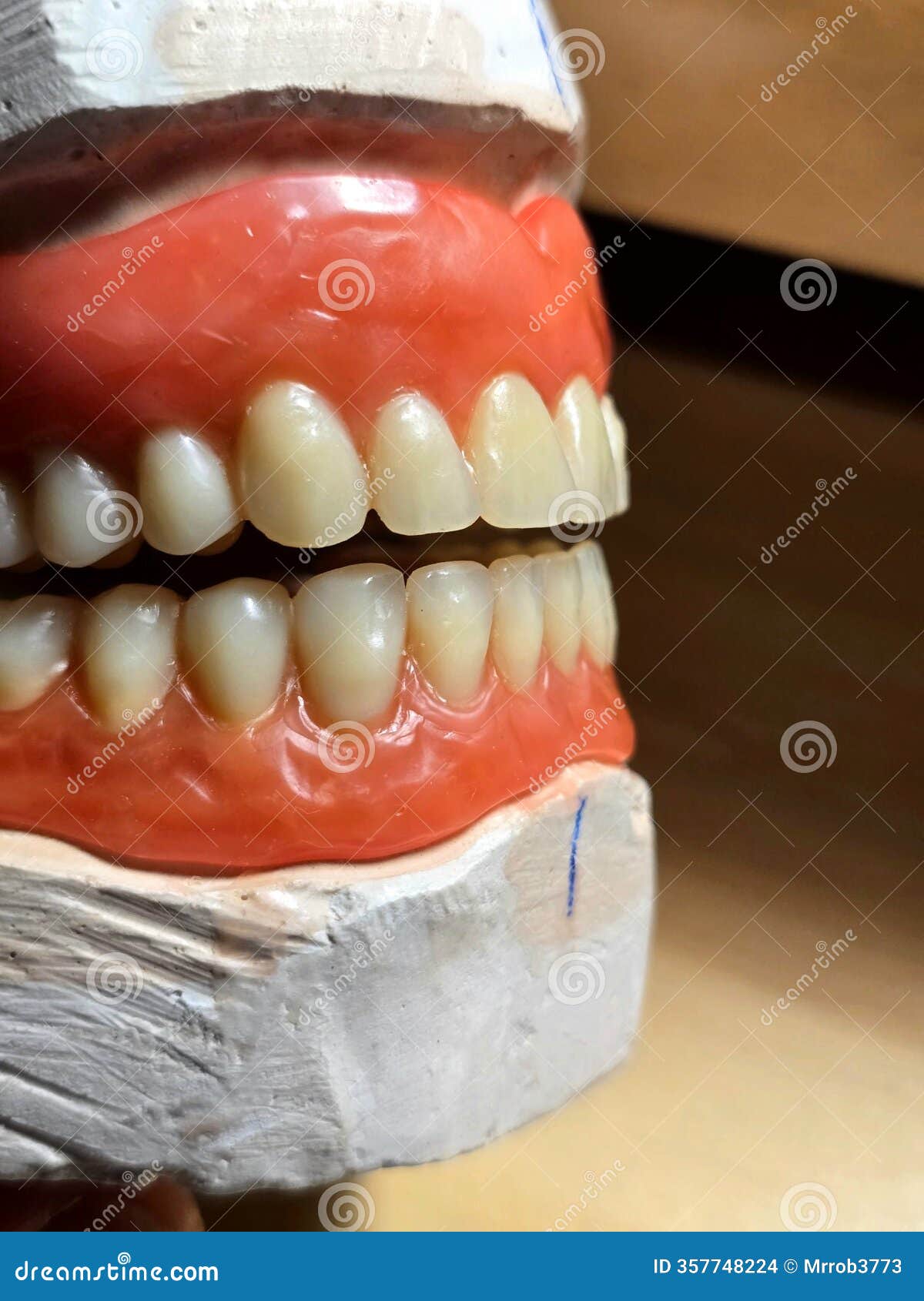 Photos of dentures in wax. stock photo. Image of face - 357748224