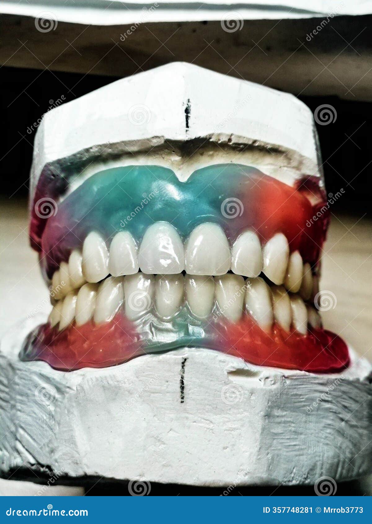 Photos of dentures in wax. stock image. Image of care - 357748281