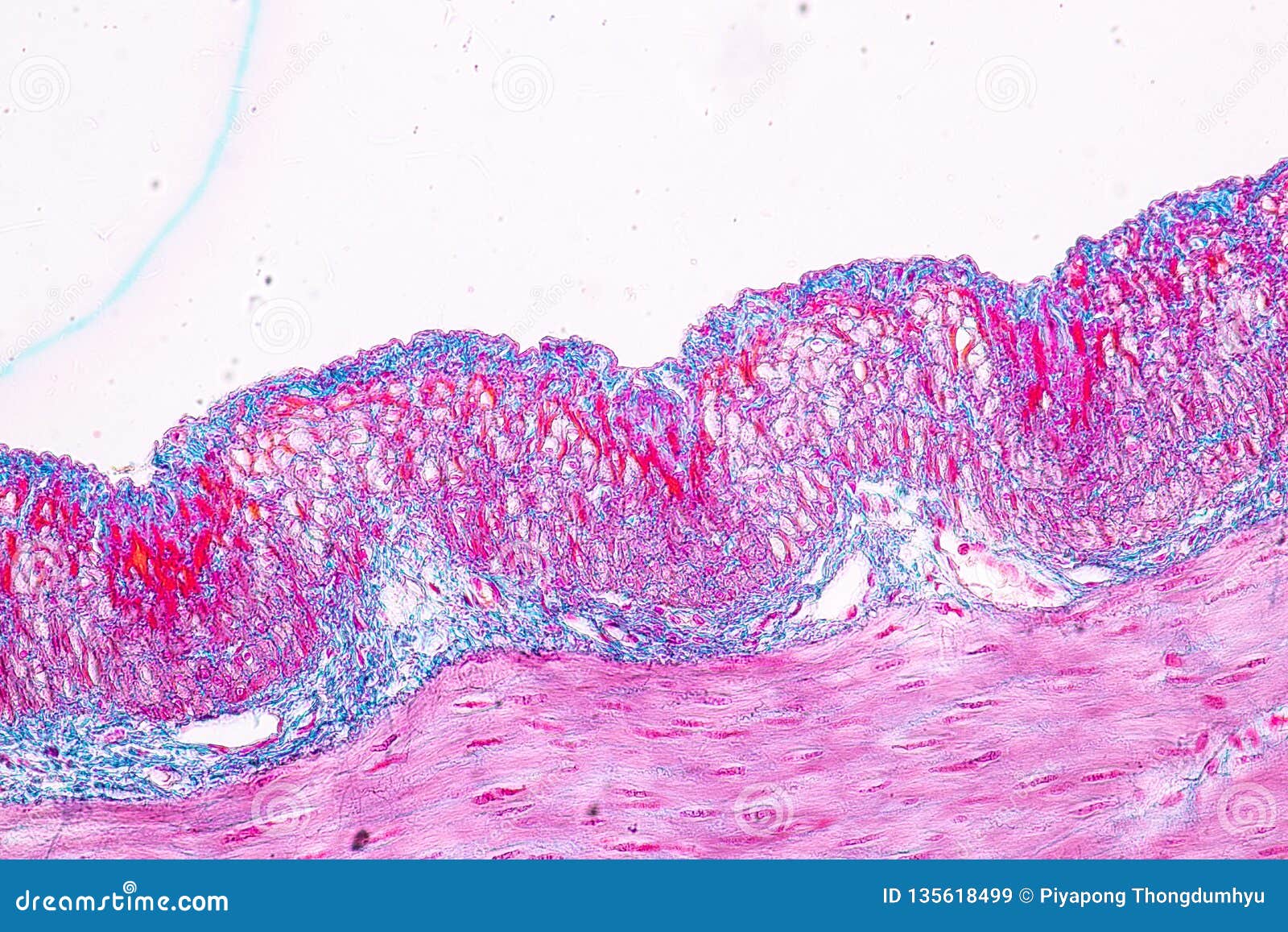 Tissue Of Stomach Under The Microscope For Education. Royalty-Free ...