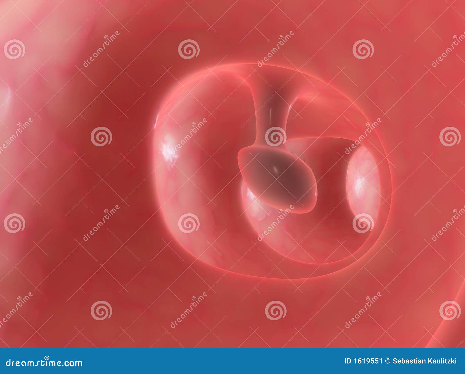 Piccolo Polyp Delle Viscere Illustrazione di Stock - Illustrazione di ...
