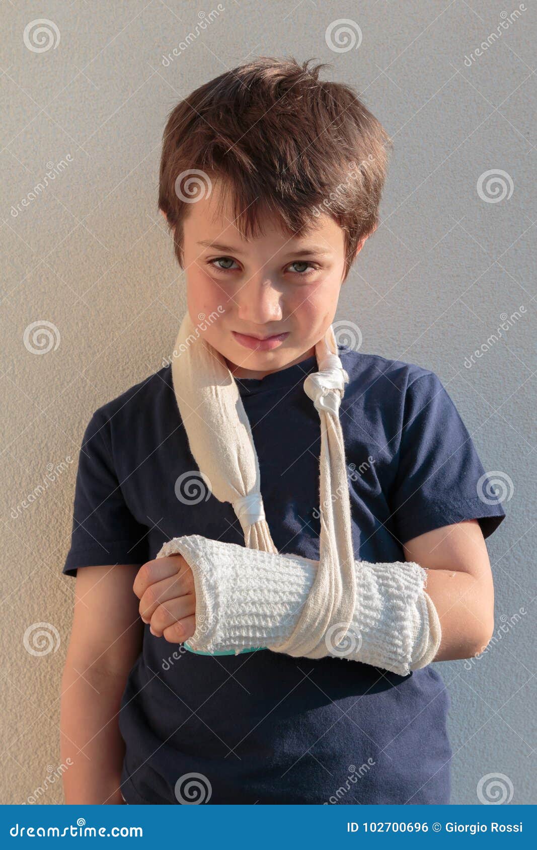Piccolo Ragazzo Caucasico Con Il Braccio Rotto Fotografia Stock ...