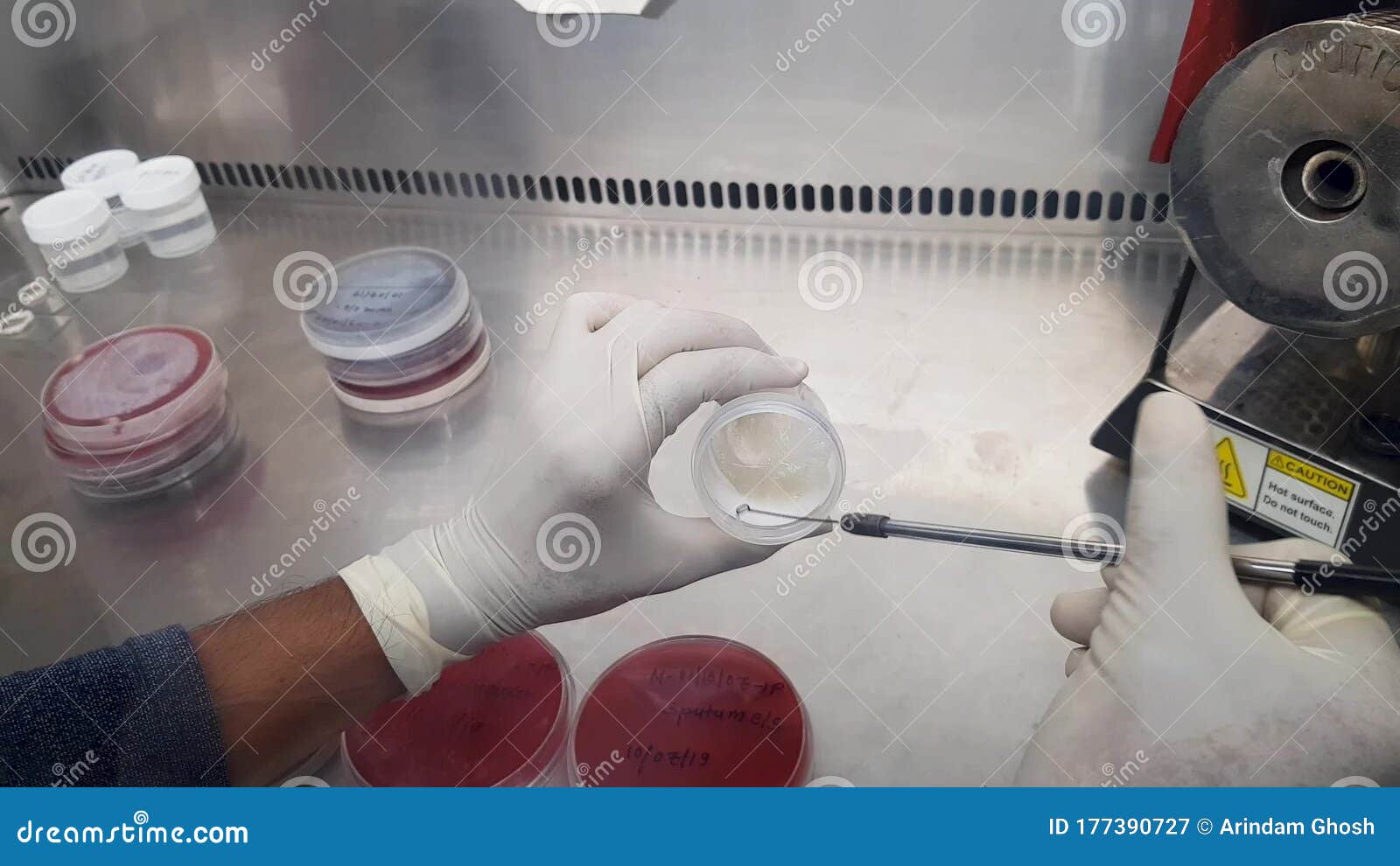 Picking Up of Pus Sample from a Sample Container Using an Inoculation ...