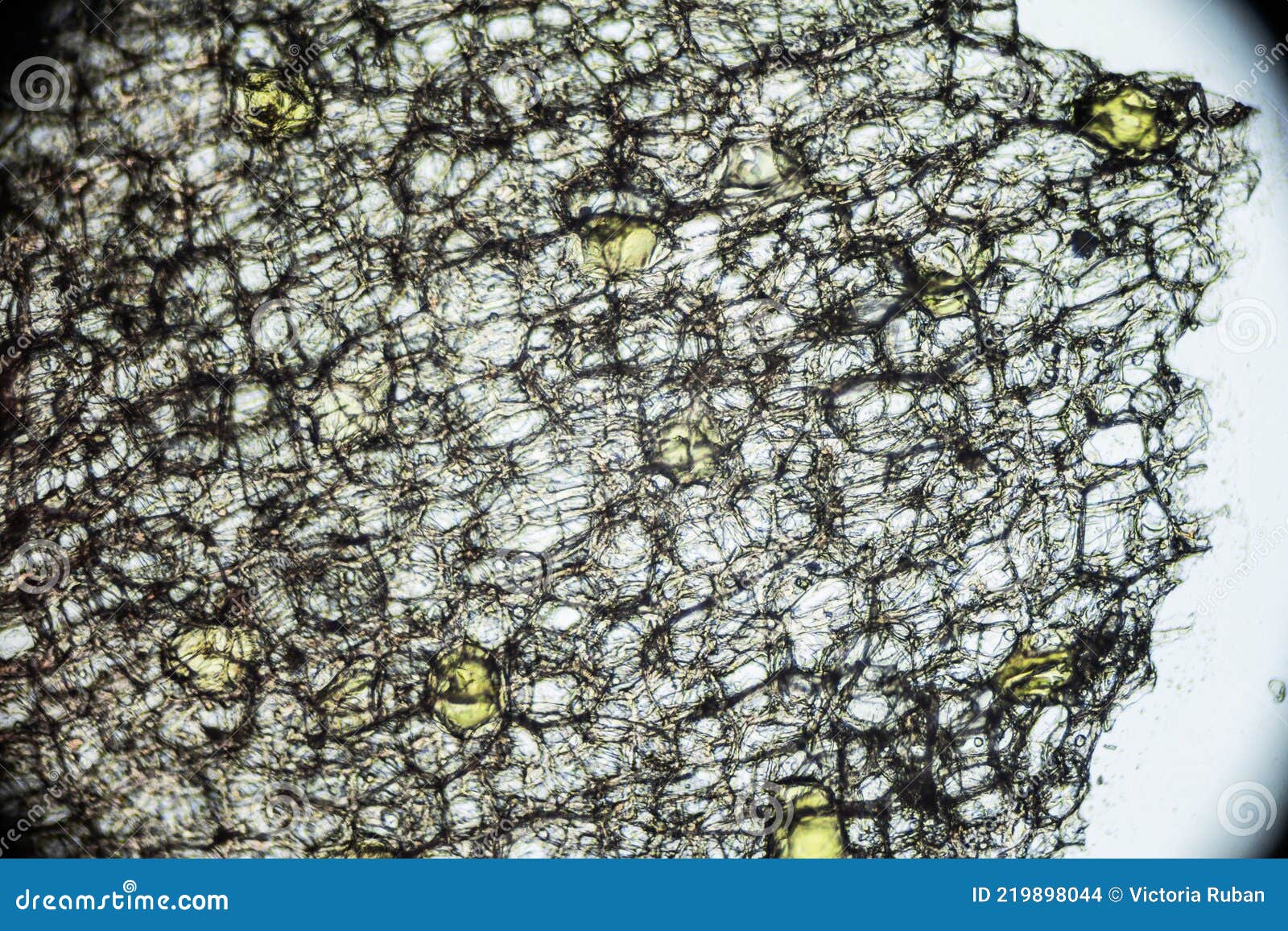 Pickled Ginger Root Under the Light Microscope Stock Photo - Image of ...