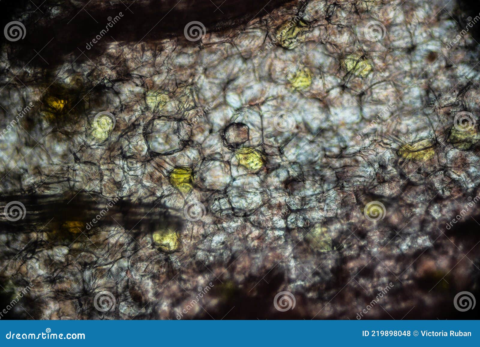 Pickled Ginger Root Under the Light Microscope Stock Photo - Image of ...