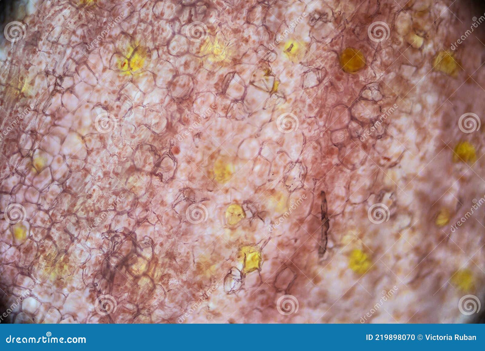 Pickled Ginger Root Under the Light Microscope Stock Photo - Image of ...