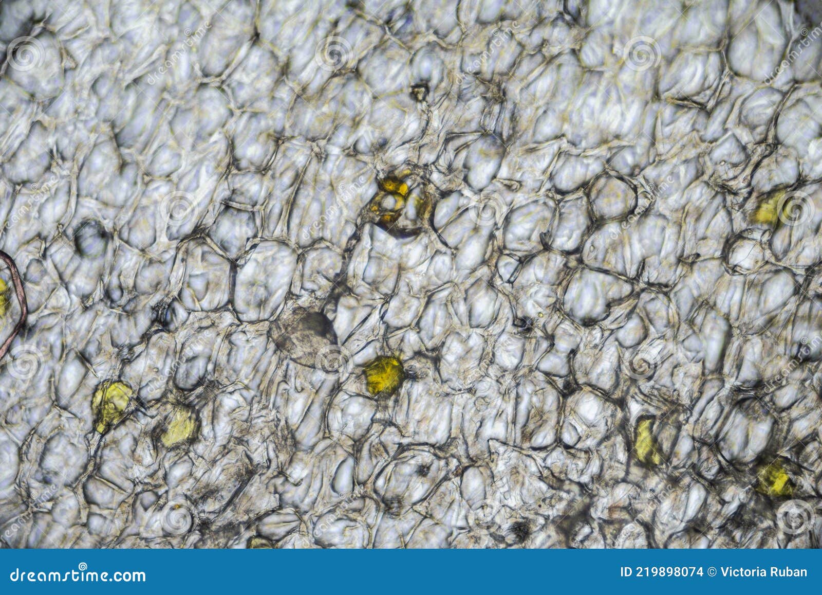 Pickled Ginger Root Under the Light Microscope Stock Photo - Image of ...