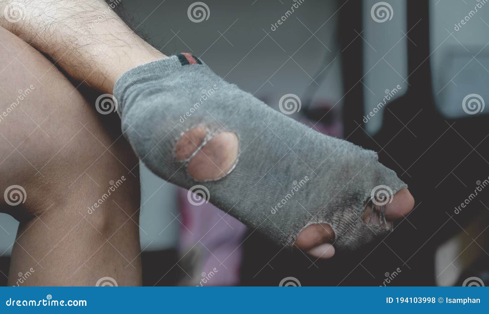 Picture of Leg Wearing Old, Dirty, and Torn Socks Stock Photo - Image ...