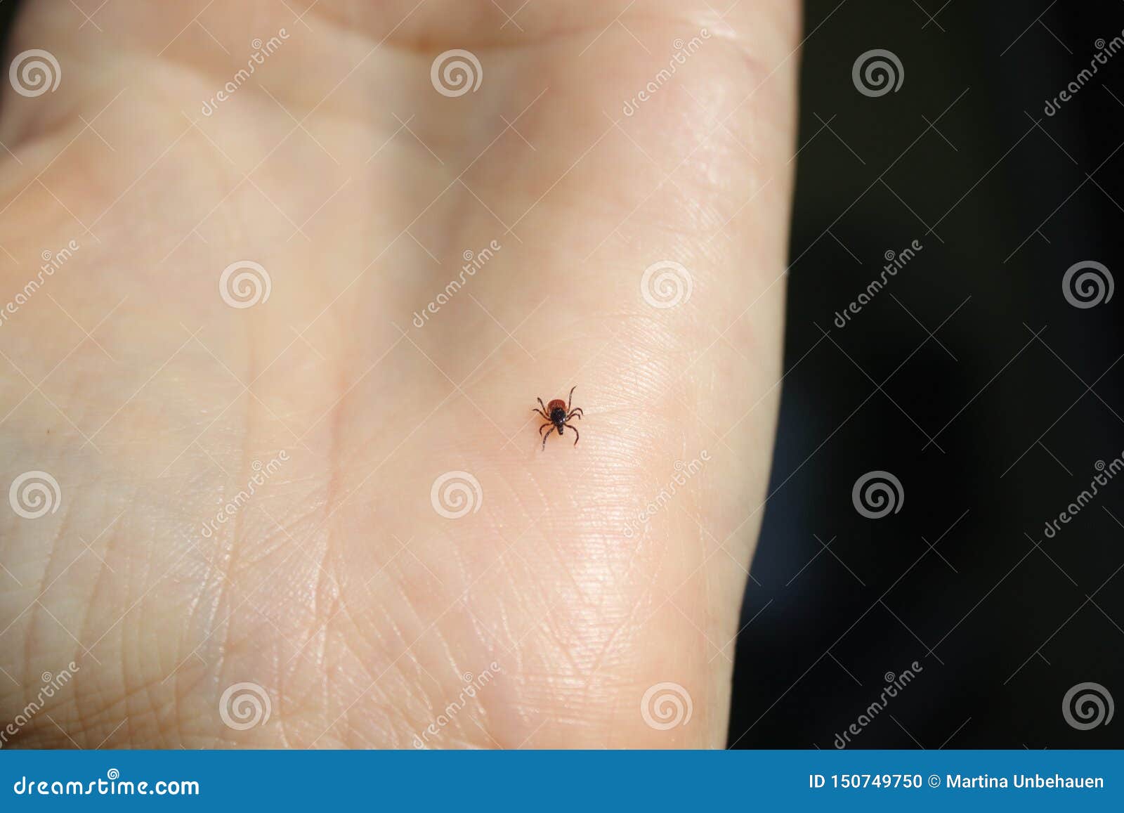 A tick on a hand stock photo. Image of blood, hand, infection - 150749750
