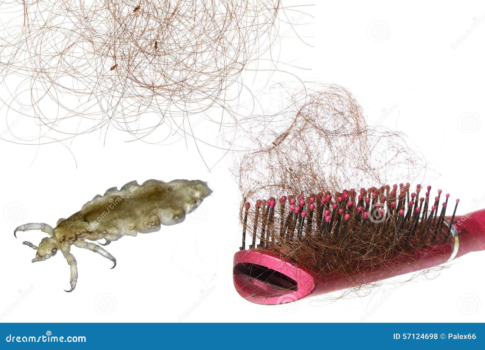 Pidocchi Del Capo (pidocchio) Fotografia Stock - Immagine di pericoloso ...