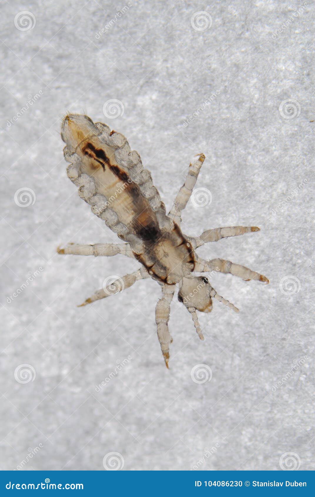 Pidocchio Del Capo - Pidocchi Del Capo Fotografia Stock - Immagine di ...