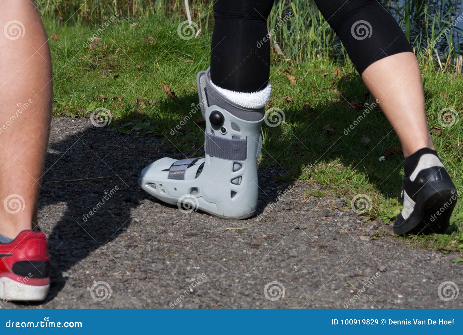 Piede Rotto in Stivale Protettivo Immagine Stock - Immagine di supporto ...