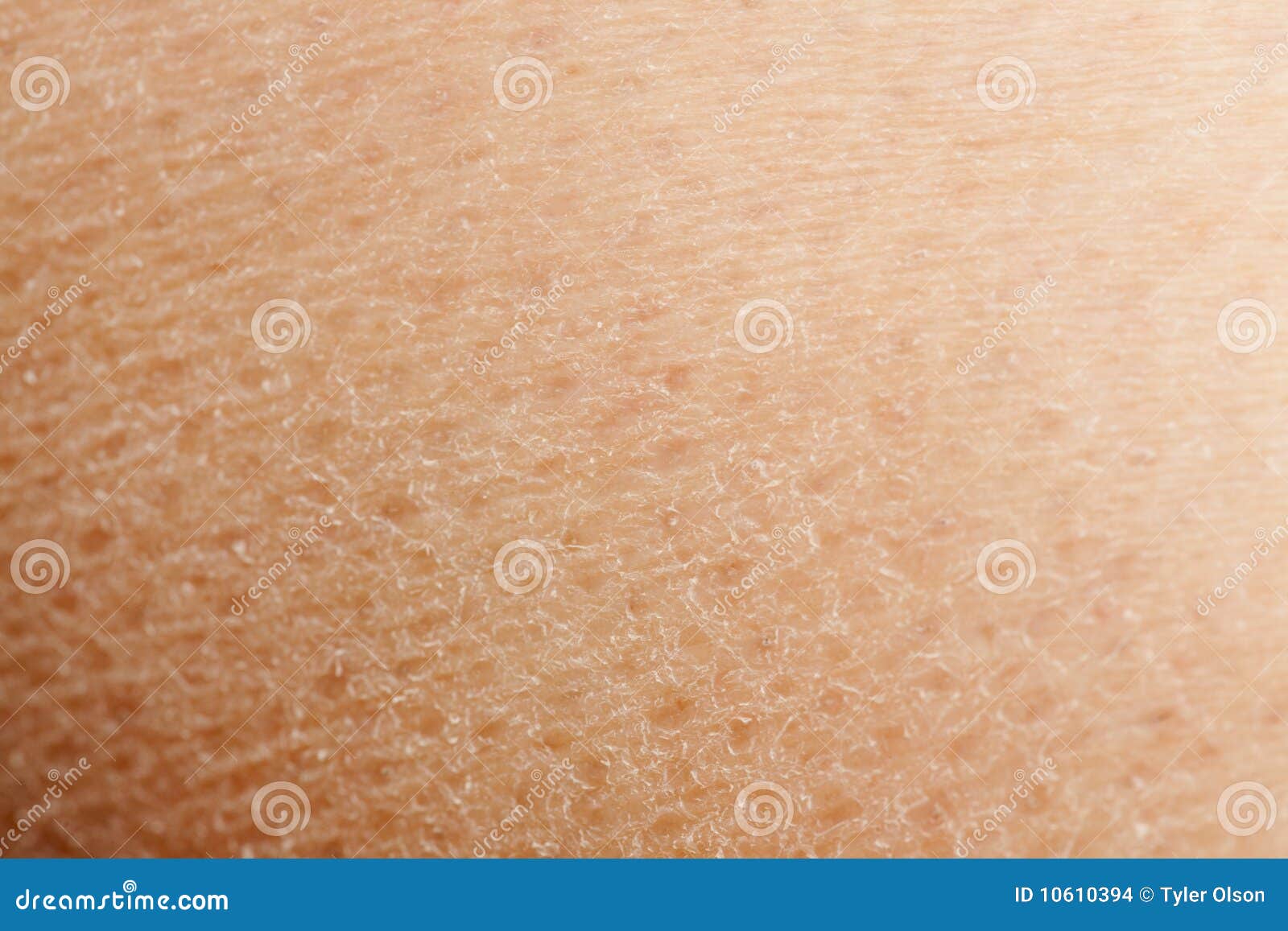 Piel seca foto de archivo. Imagen de detalle, epidermis - 10610394