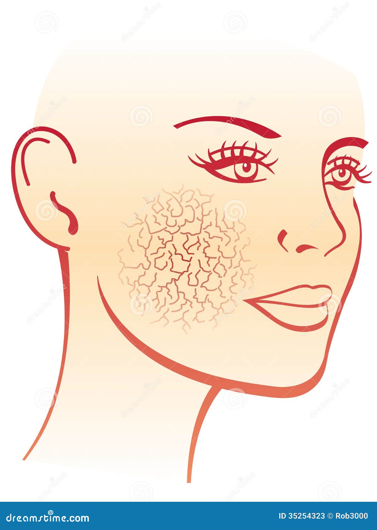 Piel seca ilustración del vector. Ilustración de sebo - 35254323